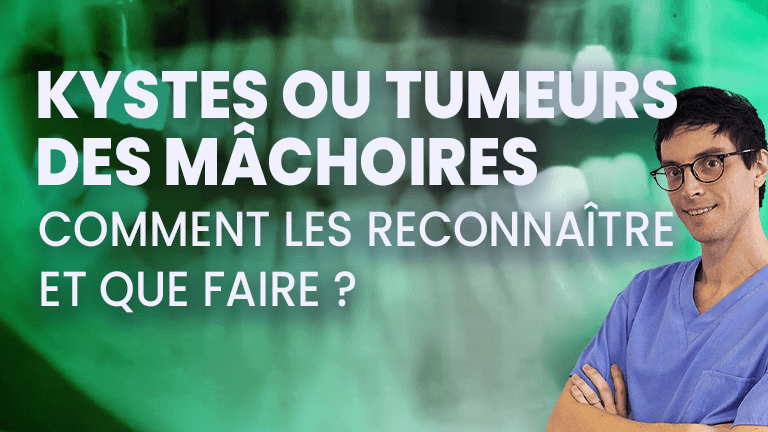 Kystes ou Tumeurs des mâchoires : comment les reconnaître et que faire ...